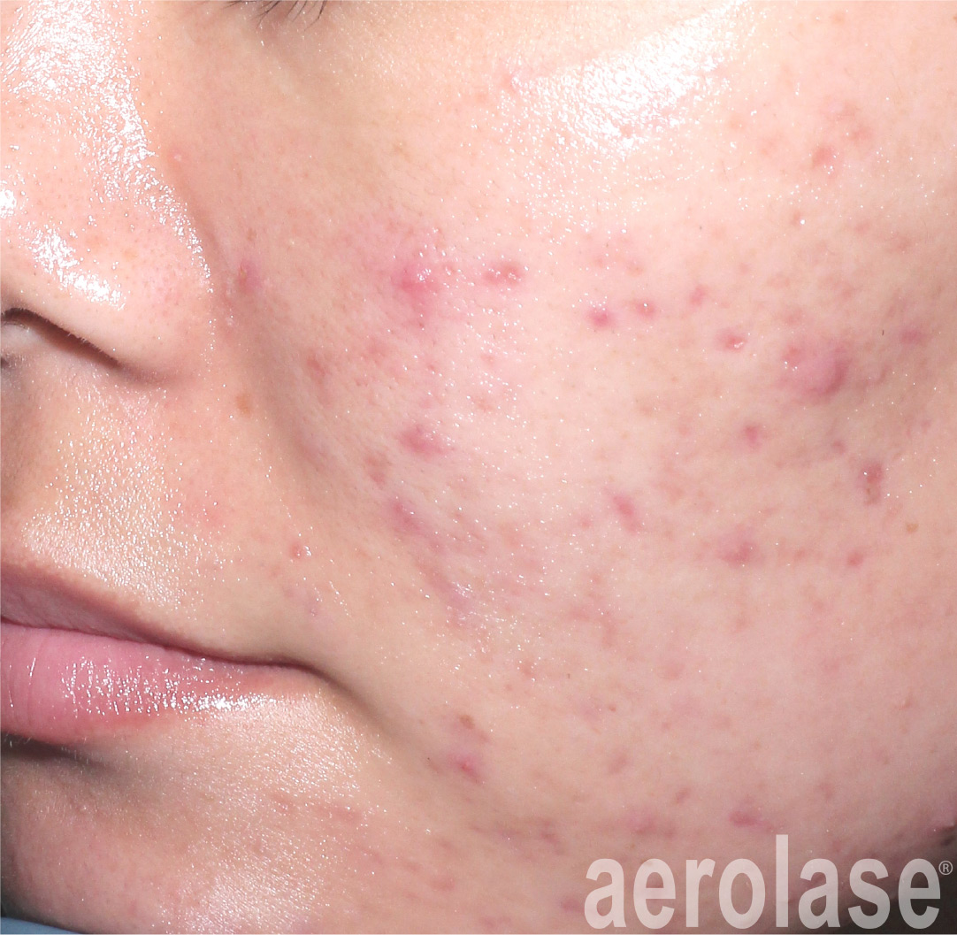 Skin Conditions | MHM Aesthetics