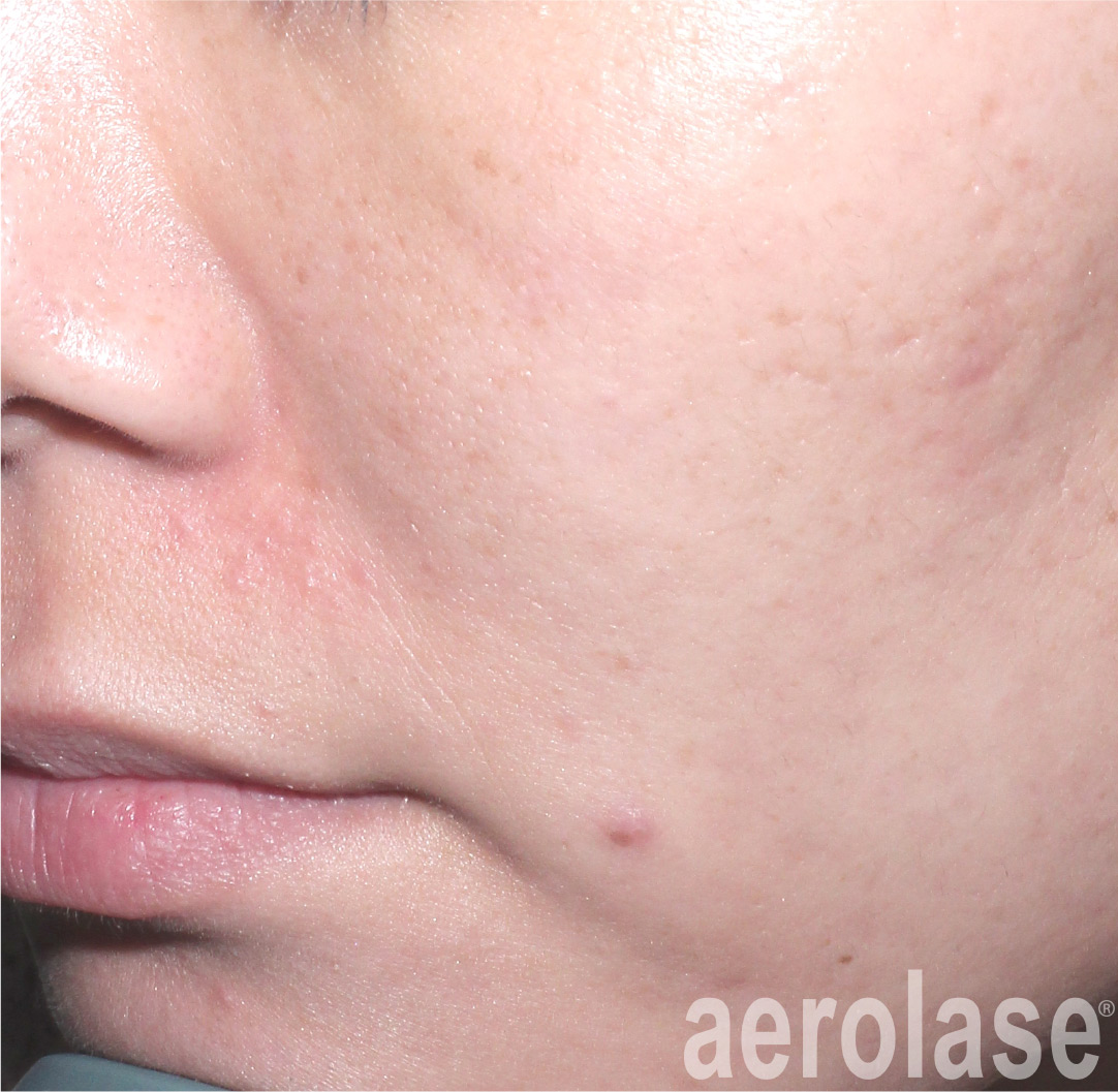 Skin Conditions | MHM Aesthetics