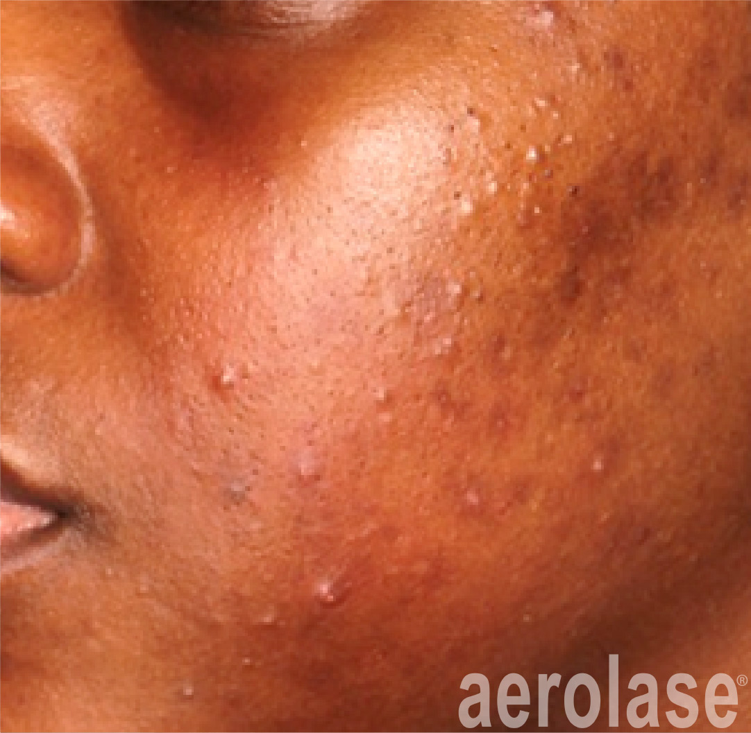 Aesthetics | MHM Aesthetics