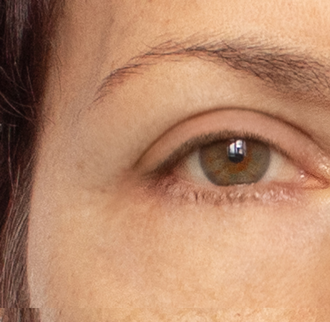 Discover Botox: The Key To Youthful, Revitalized Skin