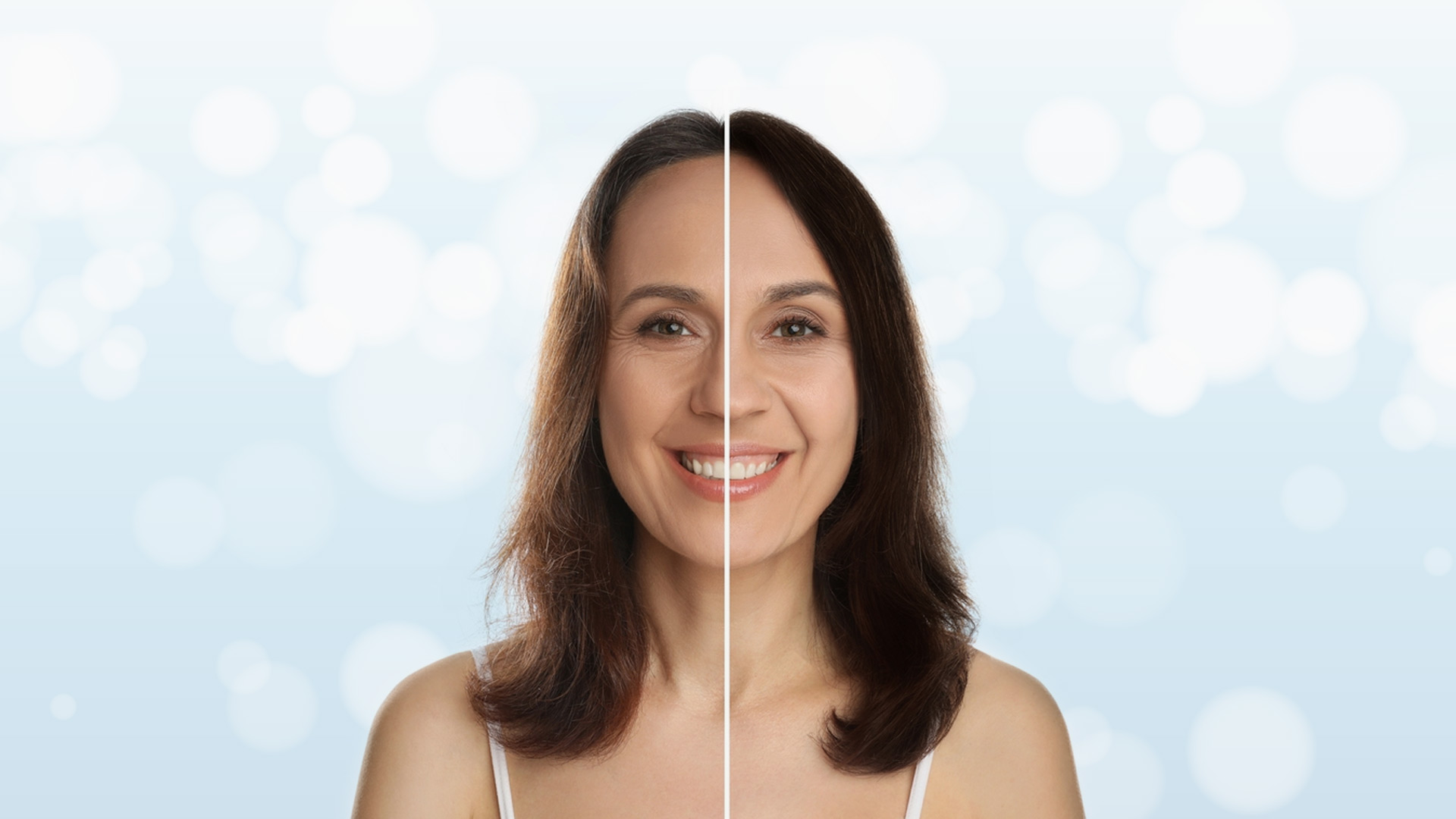 Botulinum Toxin Mhm Aesthetics