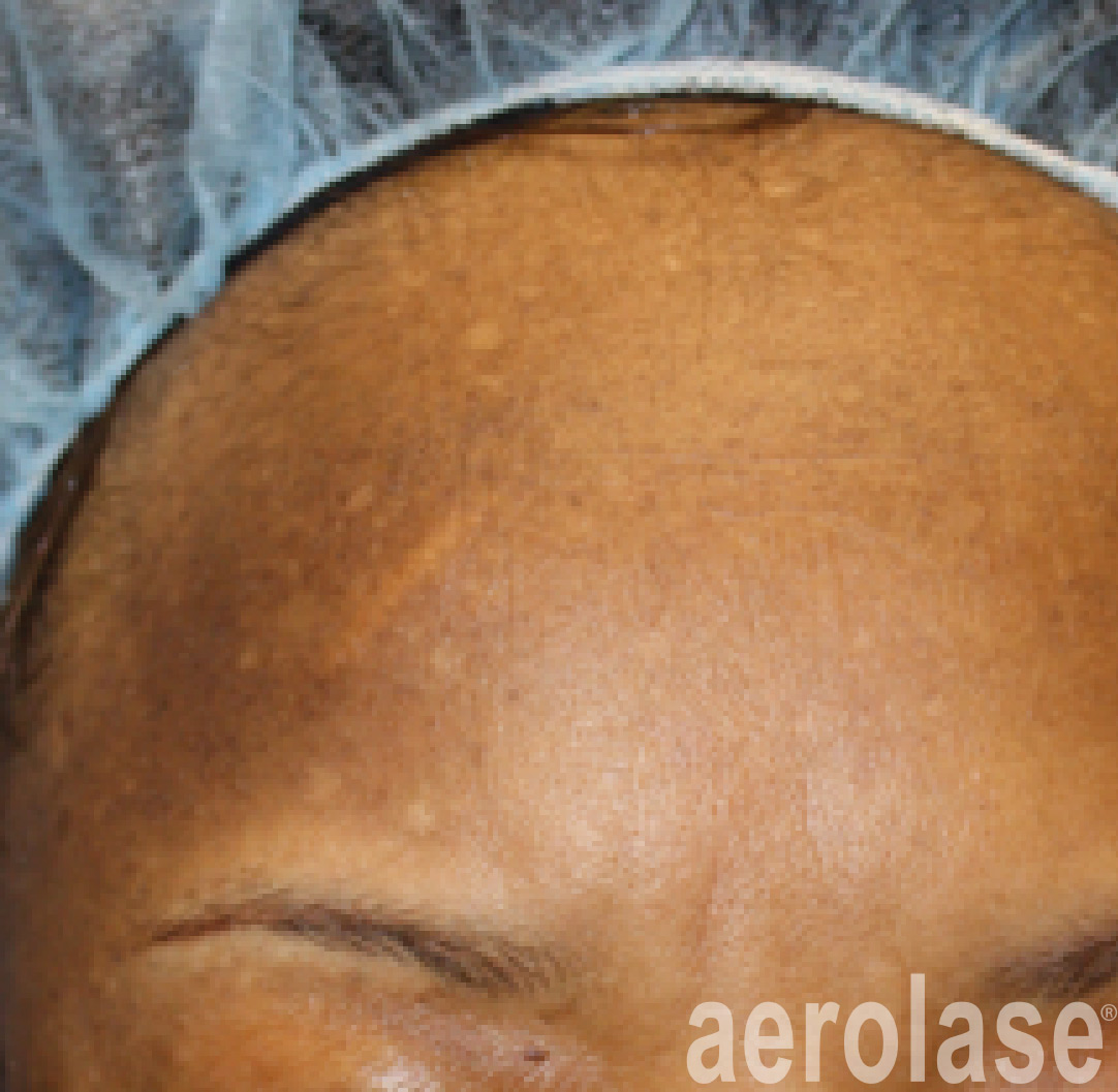 Skin Conditions | MHM Aesthetics