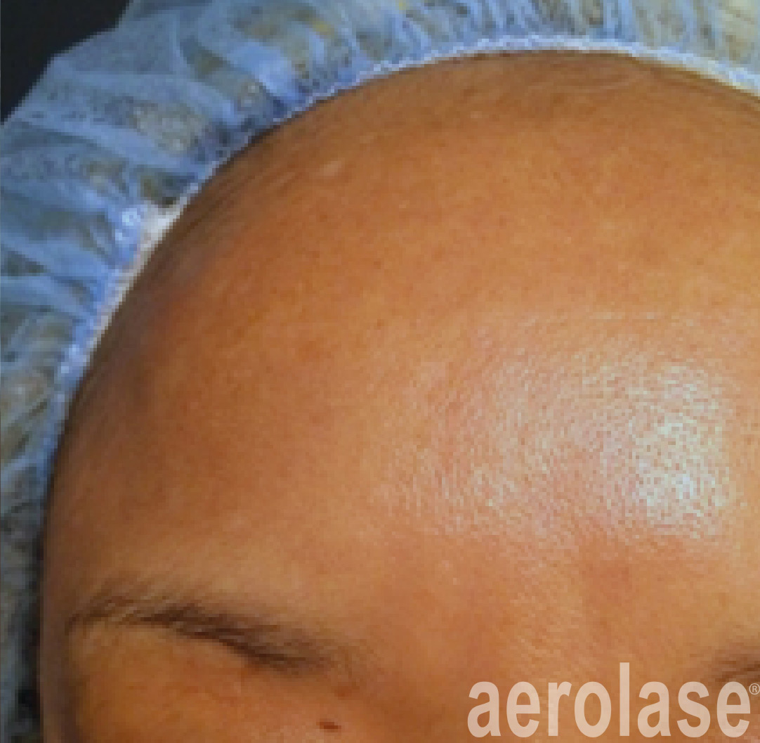 Skin Conditions | MHM Aesthetics