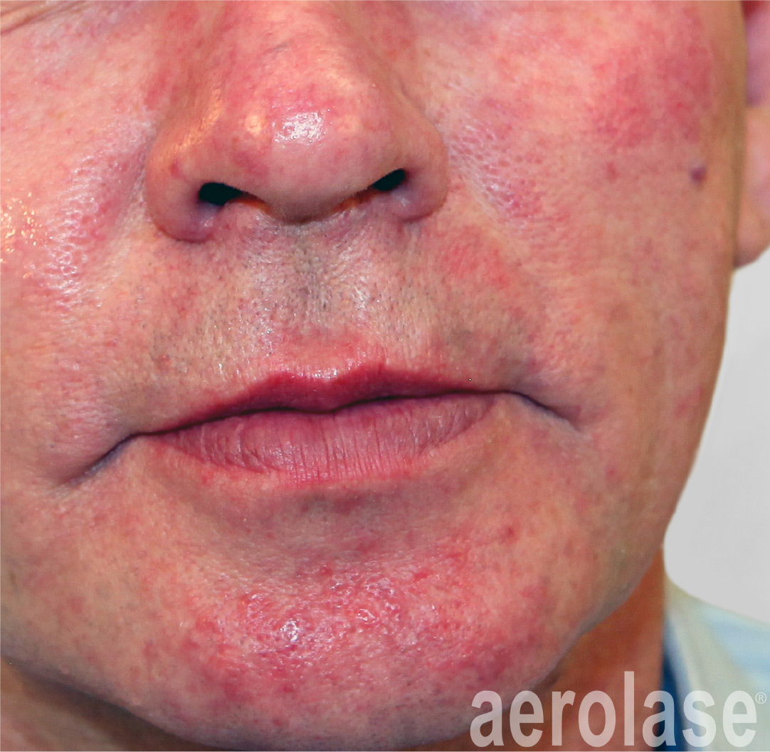 Skin Conditions | MHM Aesthetics